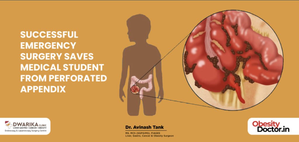 Successful Emergency Surgery Saves Medical Student from Perforated ...