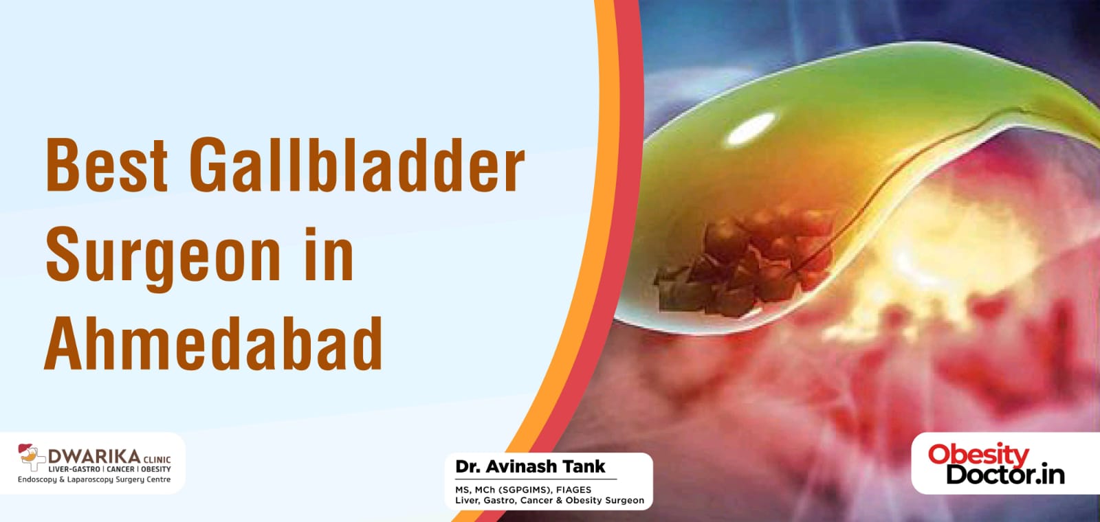 Best Gallbladder Surgeon in Ahmedabad - Dr AvinashTank, is a super ...