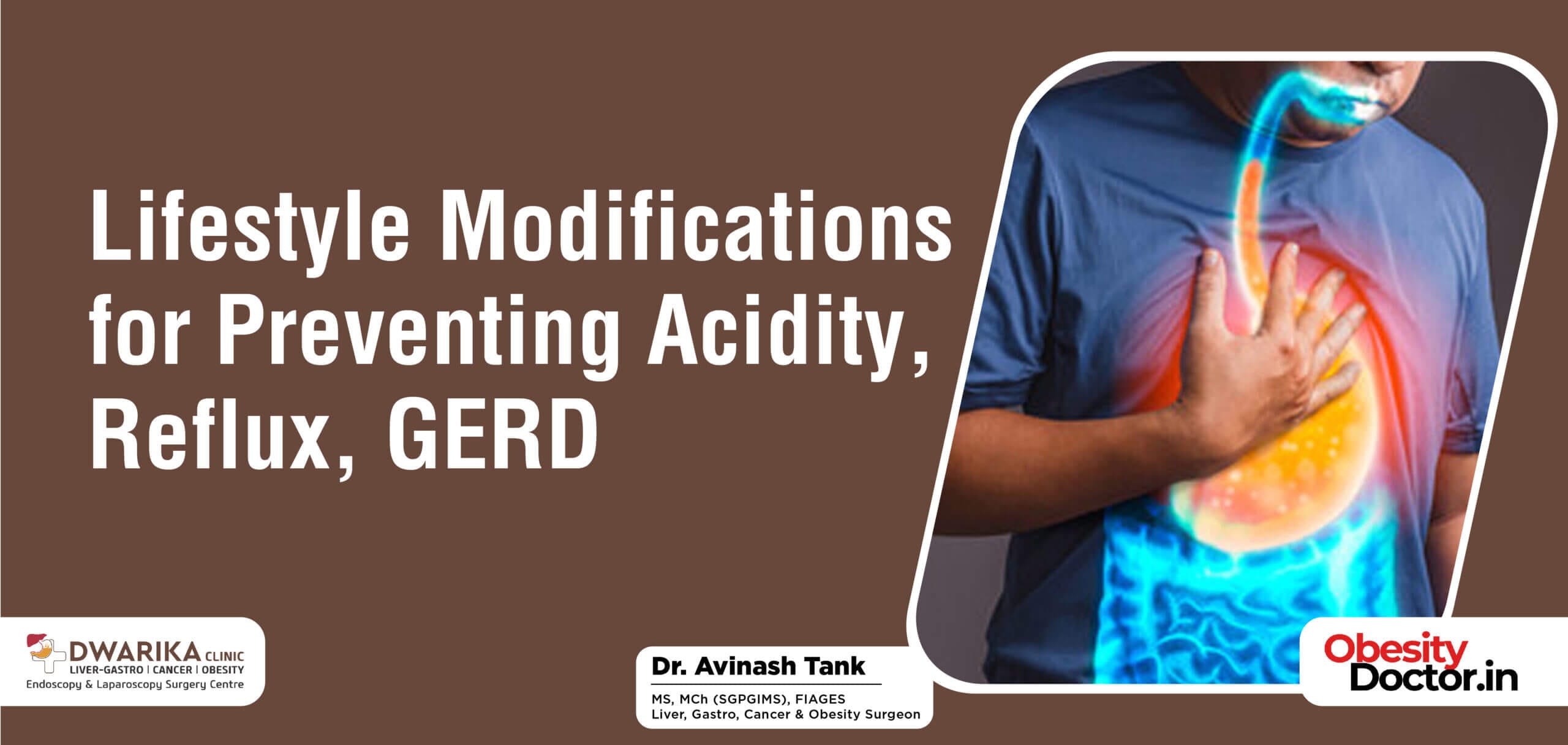 Lifestyle Modifications for Preventing Acidity.