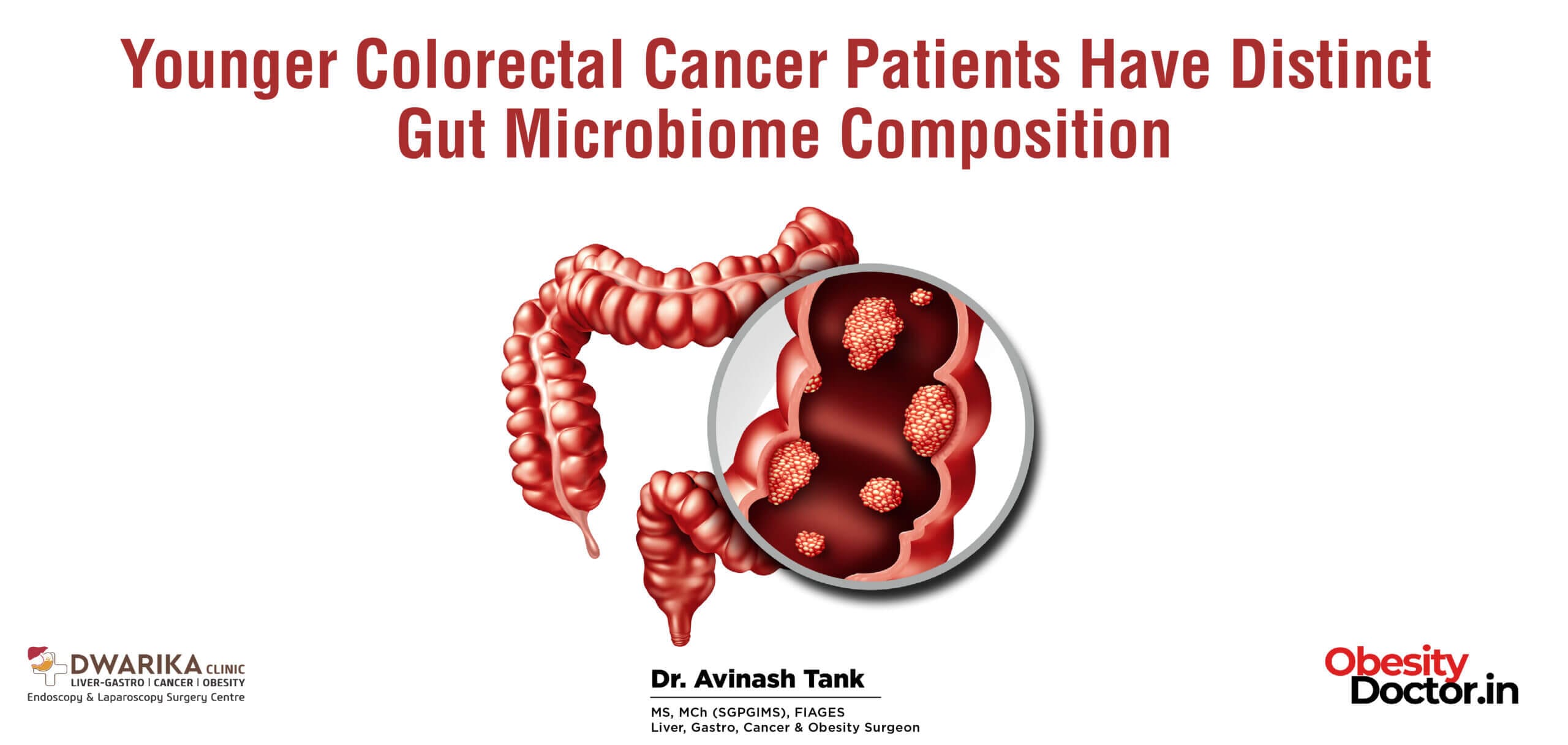 Younger Colorectal Cancer Patients Have Distinct Gut Microbiome ...