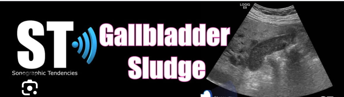 Gallbladder Sludge vs. Gallstones: Understanding the Difference - Dr AvinashTank, is a super ...